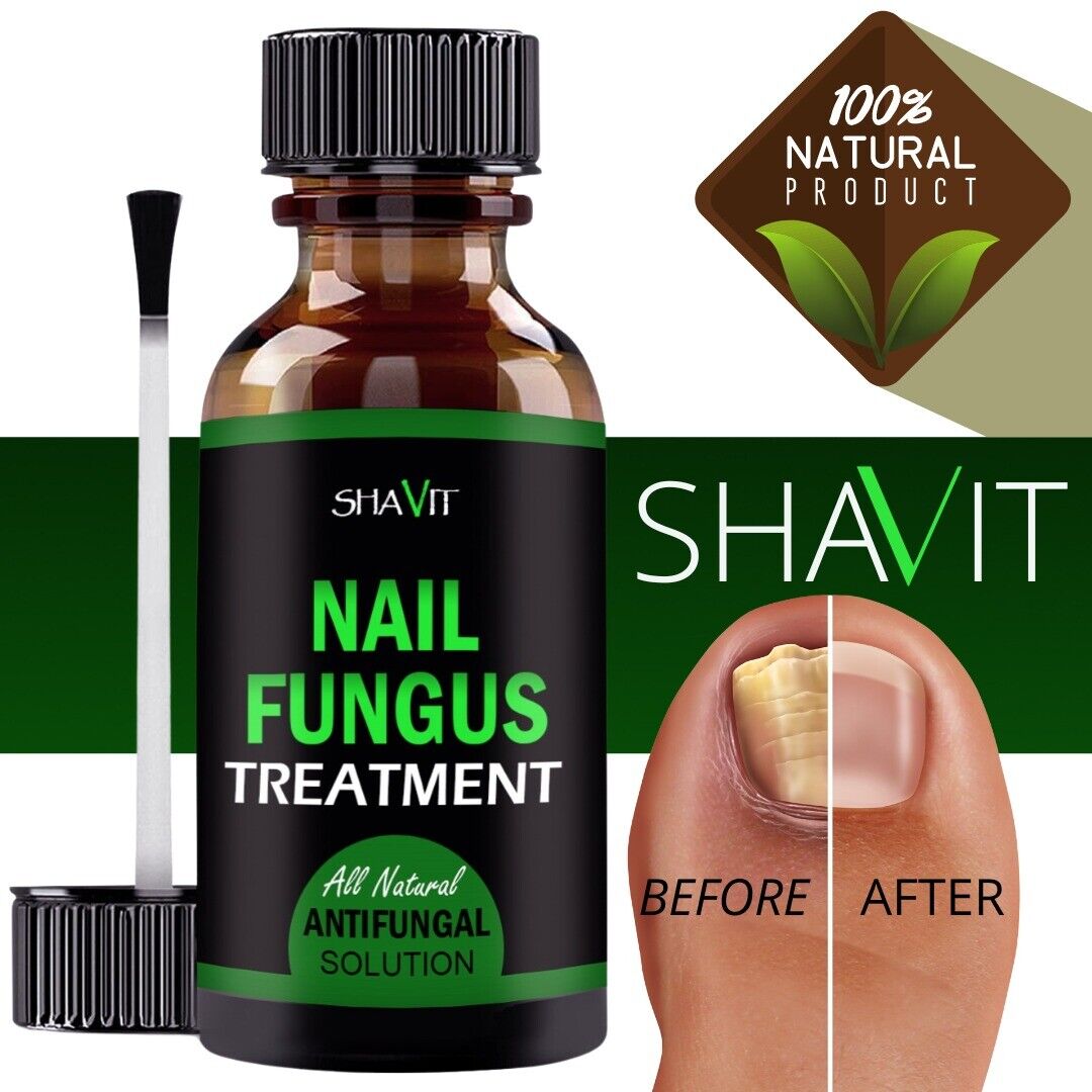 ANTI FUNGAL TREATMENT EXTRA STRENGTH TOENAIL FUNGUS ATHLETES FOOT FUNG ...